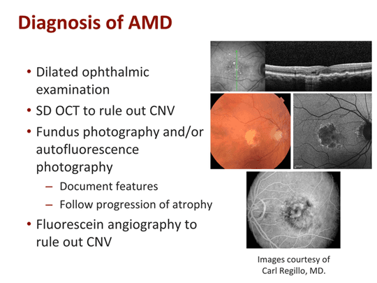 Dry AMD and GA: Where Are We Now, and Where Are We Going? (Transcript)