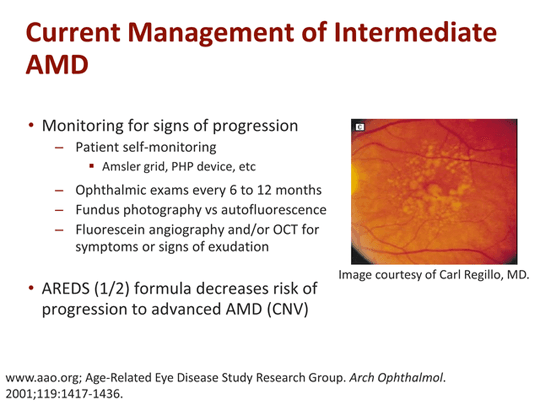 Dry AMD and GA: Where Are We Now, and Where Are We Going? (Transcript)
