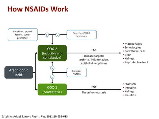 Update On NSAID Use: Cardiologist Perspectives (Transcript)