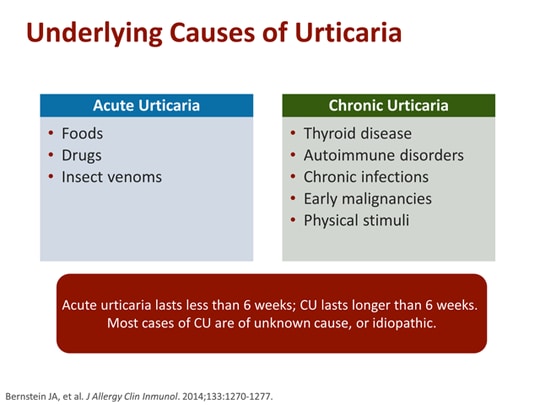 Chronic Idiopathic Urticaria: Improving Patient Outcomes and Quality of ...