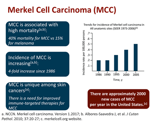 Merkel Cell Carcinoma: What Do Clinicians Need to Know? (Transcript)
