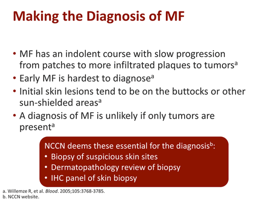 Initial Diagnosis of MF-CTCL: A Collaborative Approach (Transcript)