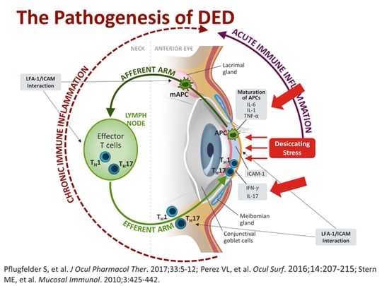 Advances in Dry Eye: Where Are We Now? (Transcript)