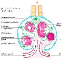 How I Treat Cryoglobulinemia