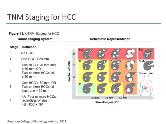 A Review of the Critical Role of Imaging in Primary Liver Malignancy ...