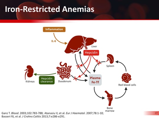 Anemia in CKD: Weighing the Evidence for Iron Deficiency Management ...