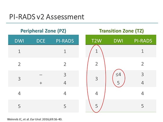 Strategies for Improving Diagnosis and Risk Stratification in Prostate ...