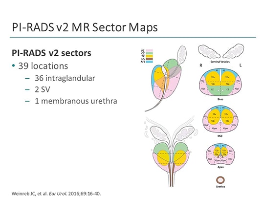 Strategies for Improving Diagnosis and Risk Stratification in Prostate ...