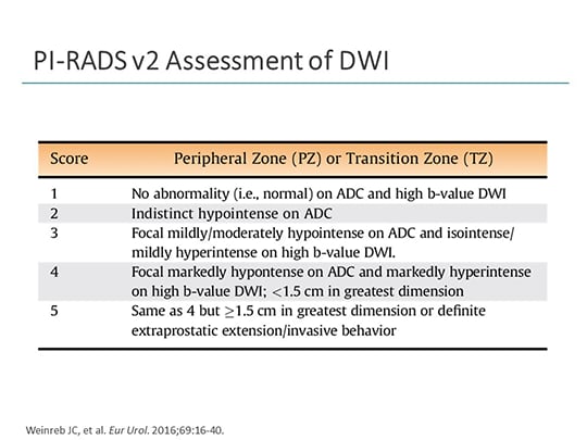 Strategies for Improving Diagnosis and Risk Stratification in Prostate ...