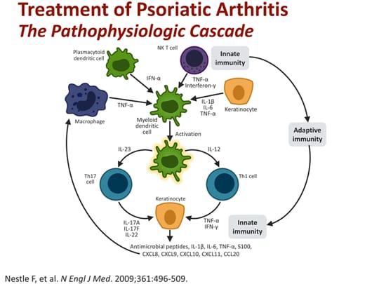 Effective Management of Psoriatic Arthritis: Tailoring Treatments (Transcript)