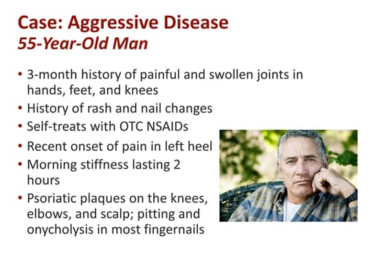 Effective Management of Psoriatic Arthritis: Tailoring Treatments (Transcript)