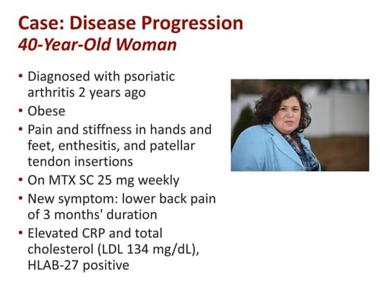 Effective Management of Psoriatic Arthritis: Tailoring Treatments (Transcript)