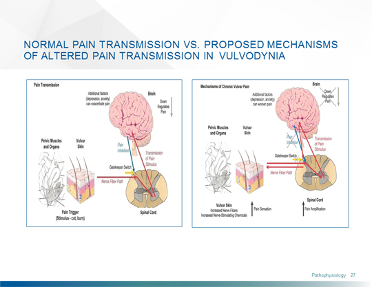 Vulvodynia: A Common and Under-Recognized Pain Disorder in Women and ...