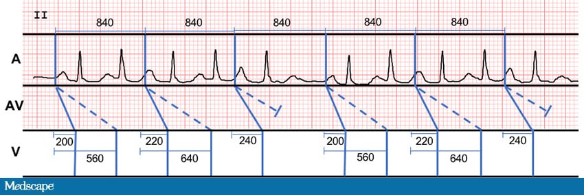 ECG Challenge: The Double-Double - Page 2