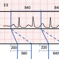 ECG Challenge: The Double-Double - Page 2