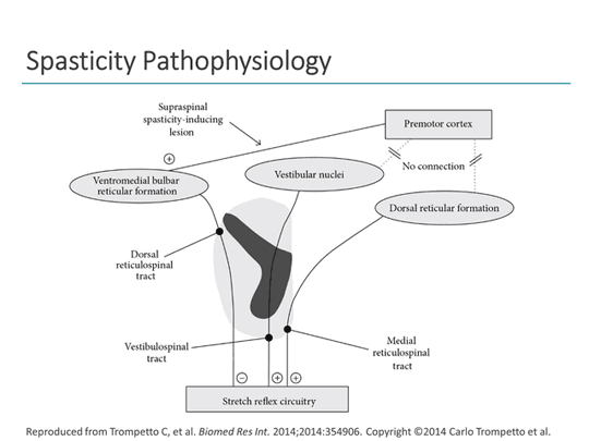 Exploring Strategies for Recognition and Management of Lower Limb ...