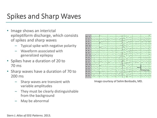 Improving Diagnostic Accuracy in Epilepsy: Understanding Outpatient EEG ...