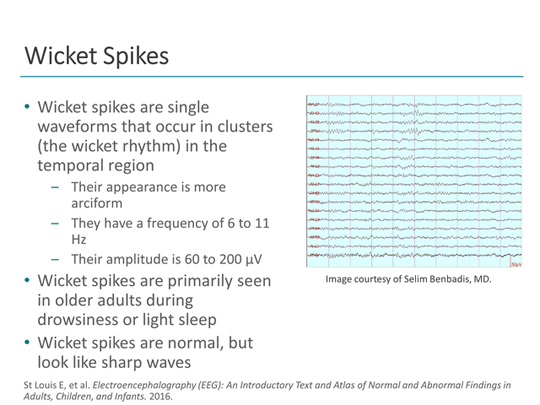Improving Diagnostic Accuracy in Epilepsy: Understanding Outpatient EEG ...