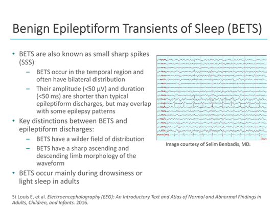 Improving Diagnostic Accuracy in Epilepsy: Understanding Outpatient EEG ...