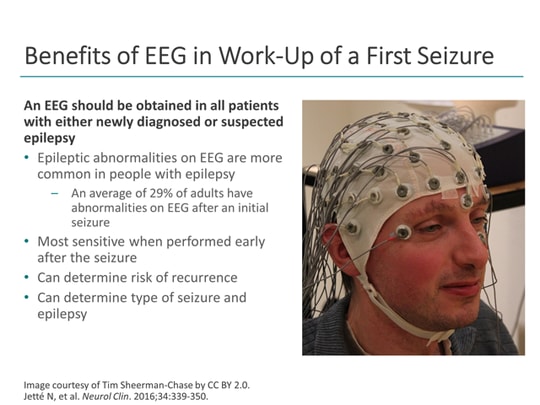 Improving Diagnostic Accuracy in Epilepsy: Understanding Outpatient EEG ...