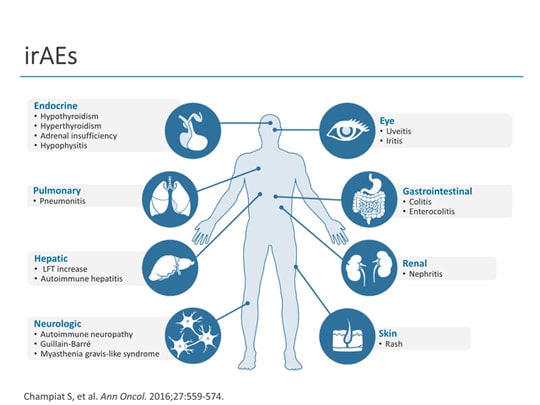 Immunotherapies: Key Considerations in the Identification and ...