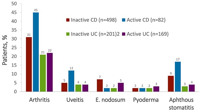 Extraintestinal Manifestations and Complications of Inflammatory Bowel ...