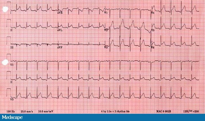 Dull Chest Pain in a 42-Year-Old Man - Page 2