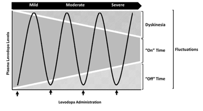 Clinical Perspectives on Wearing - Off Symptoms and Dyskinesia in ...