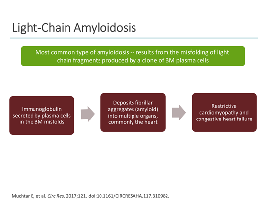 Clues to a Diagnosis: A Focus on Light-Chain Amyloidosis