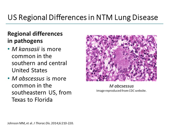 Nontuberculous Mycobacterial Lung Disease: Challenges of Long-Term Management