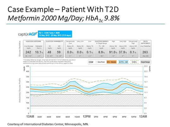 Lifestyle and Professional CGM: The Big Picture (Transcript)