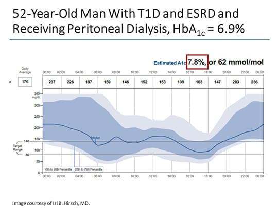 Using the AGP to Standardize Glucose Reporting: The Future of CGM