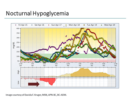 Using the AGP to Standardize Glucose Reporting: The Future of CGM