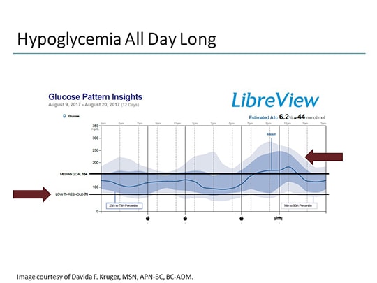 Using the AGP to Standardize Glucose Reporting: The Future of CGM