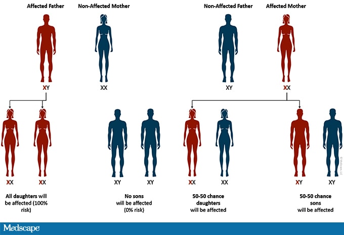 Clinical Updates on Fabry Disease: Diagnosis Through Treatment
