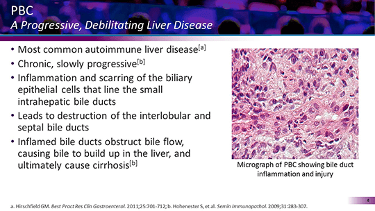 Solving the PBC Mystery: From Missing Clues to Diagnosis and Improved ...