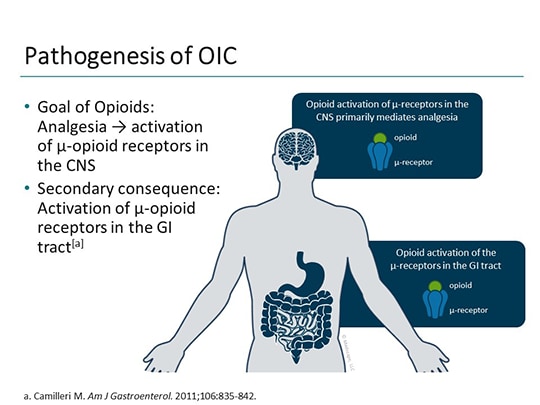 A Frontline Clinician's Guide to Managing Opioid-Induced Constipation ...