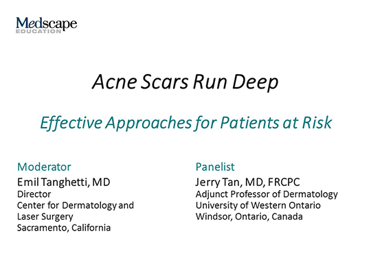 Acne Scars Run Deep: Effective Approaches for Patients at Risk