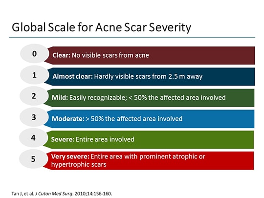 Acne Scars Run Deep: Effective Approaches for Patients at Risk