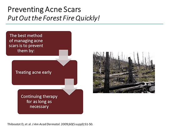 Acne Scars Run Deep: Effective Approaches for Patients at Risk