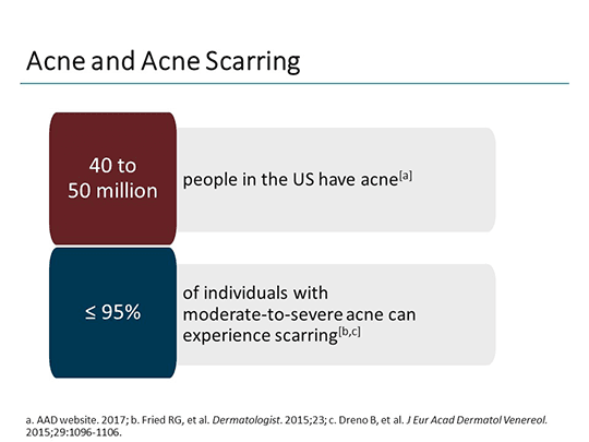 Acne Scars Run Deep: Effective Approaches for Patients at Risk