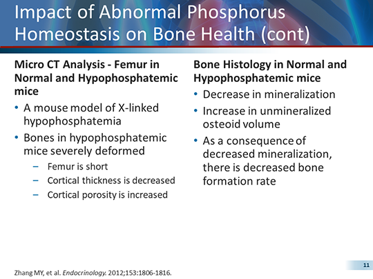 Hereditary Hypophosphatemia: Diagnostic Challenges and Potential New ...