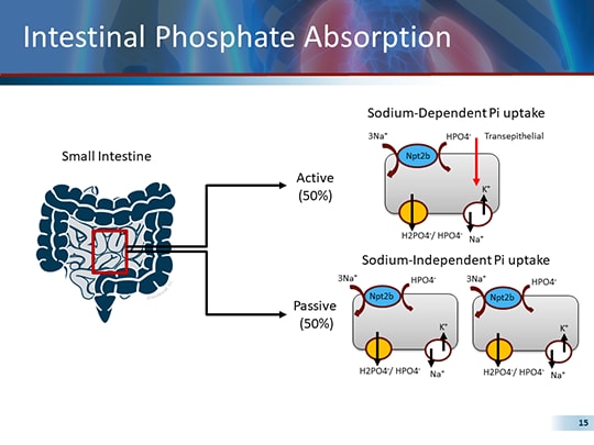 Hereditary Hypophosphatemia: Diagnostic Challenges and Potential New ...