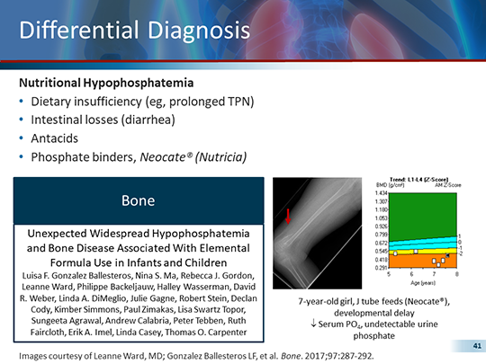 Hereditary Hypophosphatemia: Diagnostic Challenges and Potential New ...