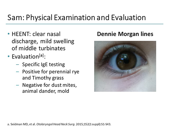 Seasonal Allergic Rhinitis: Guideline Updates Applied to Clinical Cases