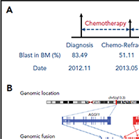 PDGFRB Mutation and Tyrosine Kinase Inhibitor Resistance in Ph-Like ...