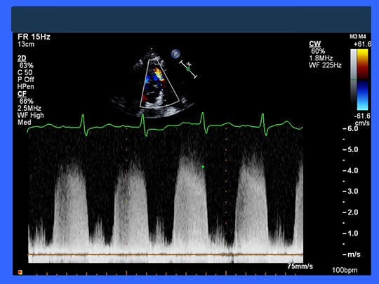 Echo Case: Possibly an All-Time Record Case of…