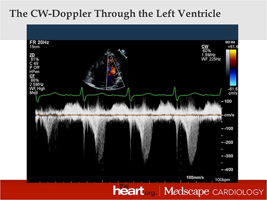 Echo Case: Possibly an All-Time Record Case of…