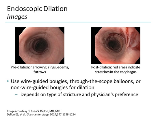 Ask the Experts: Guidelines and Emerging Advances for Treatment of ...