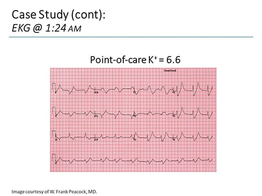 Hyperkalemia in the Hospital: Special Considerations and Novel ...
